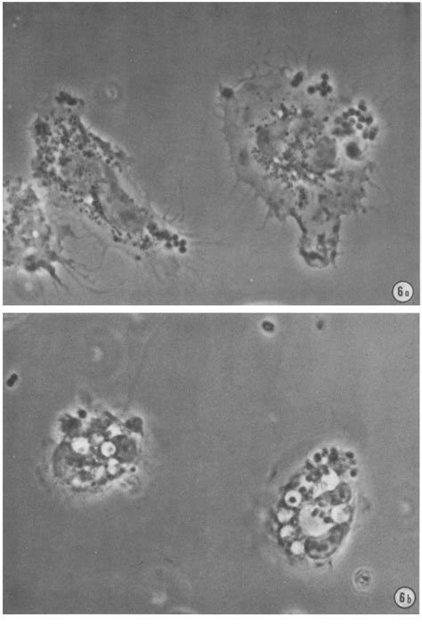Figure 6 From The Interaction In Vitro Between Human Polymorphonuclear Leukocytes And Neisseria