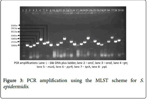 Journal Of Infectious Diseases And Therapy Multilocus Sequence Typing And Molecular Detection Of