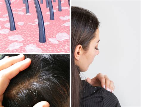 Importance Of Scalp Health The Secret To Strong Radiant Hair Arianne Beerbower