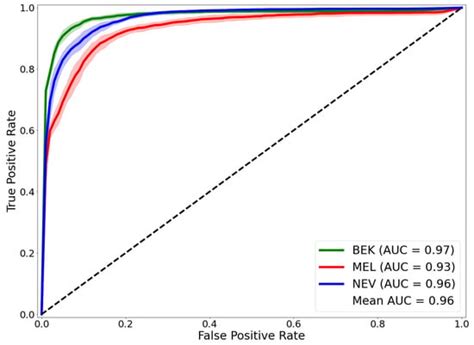 Computer Aided Diagnosis Of Melanoma Using Deep Neural Networks And Game Theory Application On