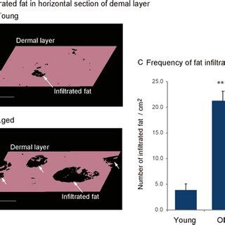 Severity Of Fat Infiltration Increases With Aging A Babe And B Download Scientific