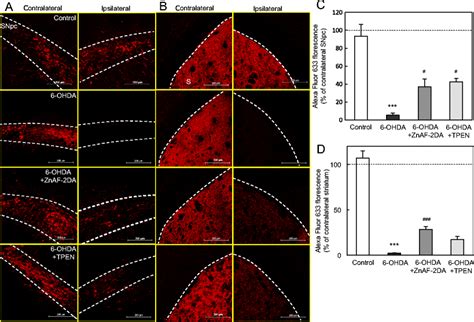 Neuronal Loss In The Snpc And Striatum After Injection Of 6 Ohda Into