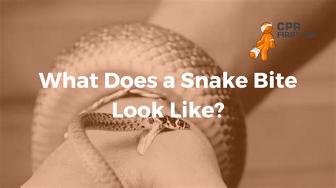 What Does A Snake Bite Look Like Cpr First Aid