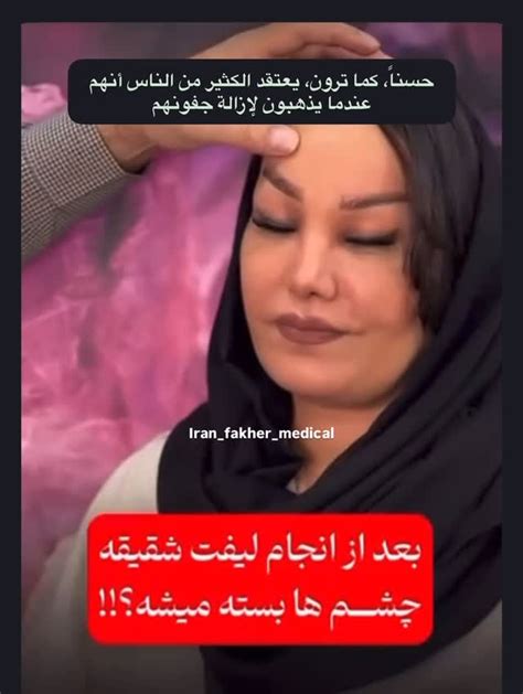 ‎مترجمة في ایران زراعة الشعر في تهران تجمیلات في ایران‎ Iranfakhermedical • Instagram