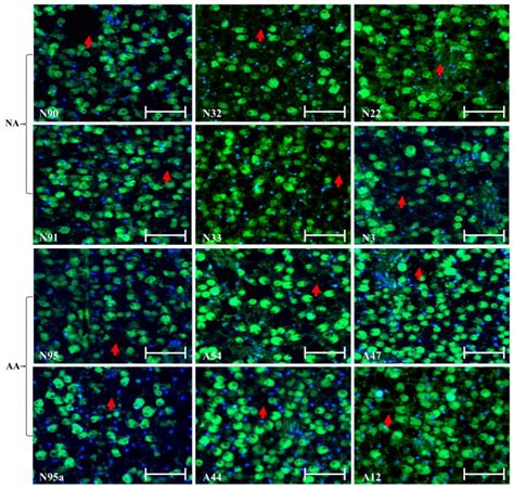 Tunel Assay And Dapi Staining Revealed Few Alterations Of Cellular