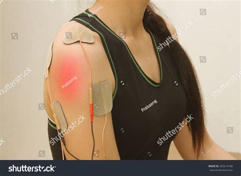 Electrodes Device On Shoulder Transcutaneous Interferential Electrical Stimulation Tens