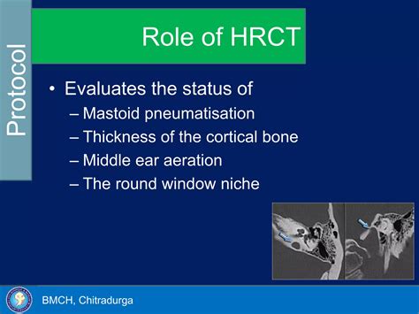 Cochlear Implant Imaging Ppsx