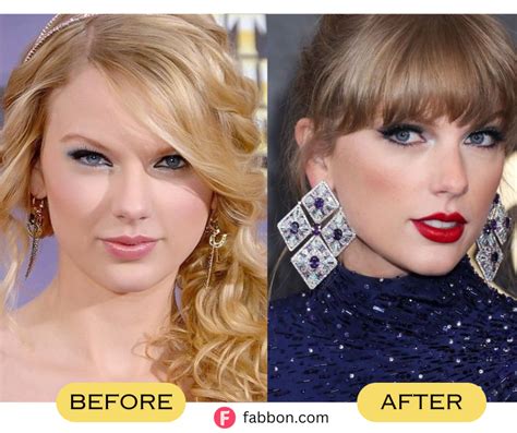 Did Taylor Swift Get Surgery Taylor Swift Plastic Surgery Comparison