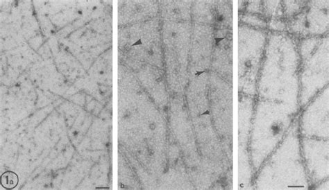 Microfilament Fraction I From RE Cells The Fraction Contained Download Scientific Diagram