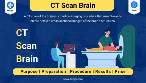Spect Ct Scan Brain Ct Scan Machine