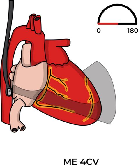 Standard Views Of The Mitral Valve