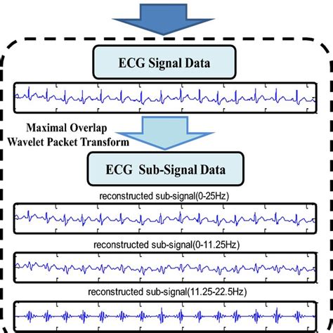 Overall Procedures In ECG Arrhythmia Classification Based On Proposed
