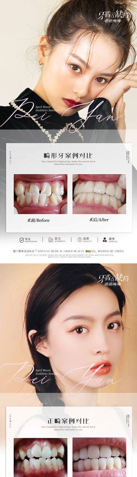 医美牙齿矫正海报psd广告设计素材海报模板免费下载 享设计