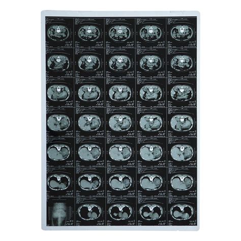 Fuji Drypix 3500 Radiology Equipment Xray Digitalizador De Rayos X Xray