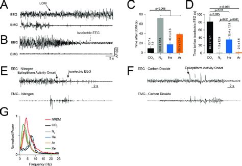 Timing Of Epileptiform Event Onset A Representative EEG EMG Trace Download Scientific