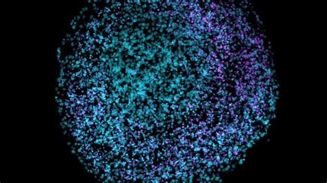 Using Lab Grown Human Mini Brains Research Suggests Concussions Could… Canada Healthwatch