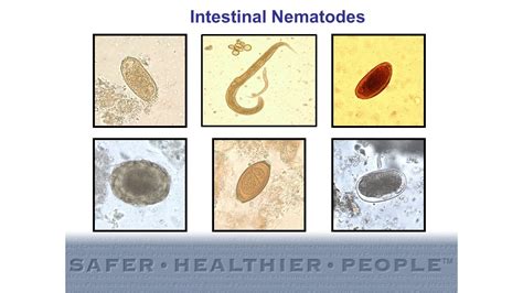 Examples Of Nematoda Ppt Worm Phyla Powerpoint Presentation Free