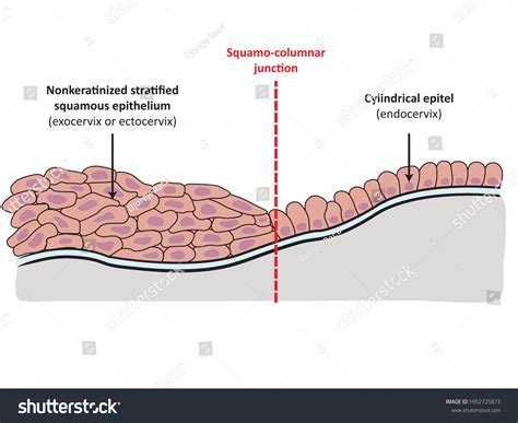 Columnar Junction At Raymond Falgoust Blog