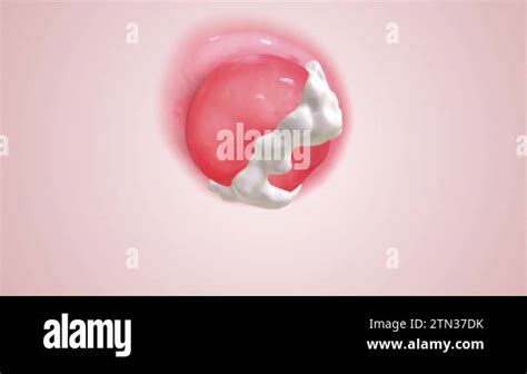 Cervicitis Stock Videos And Footage Hd And 4k Video Clips Alamy