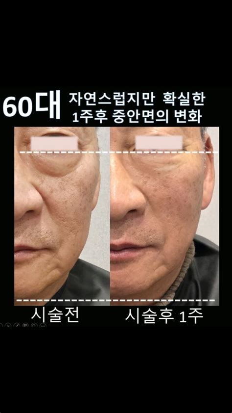 닥터고운선 대미레학회다녀왔습니다 수료증 인증샷과 함께 학회가 축제 같은 분위기 즐겁게 즐기고왔습니다 학회 나공찬회장님과도 반가운 얼굴의 한피성 학회