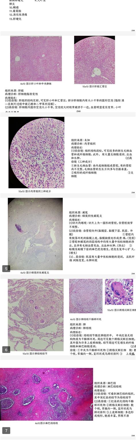 【病理学】重要切片 知乎