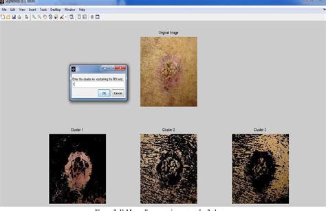 Figure 2 From Skin Disease Detection And Classification Using Image Processing And Machine