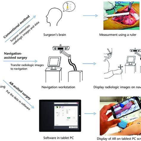 Schematic Diagrams Of Workflows According To The Methods For