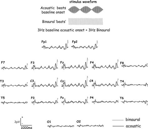 Figure 1 From A Comparison Of Auditory Evoked Potentials To Acoustic Beats And To Binaural Beats