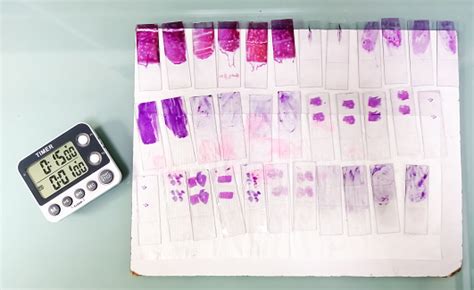 Histological Stained Slide And Timer Isolated Histological Slide