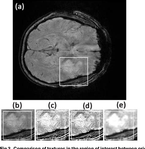 Figure 3 From A Variable Order Fractional Differential Based Texture Enhancement Algorithm With