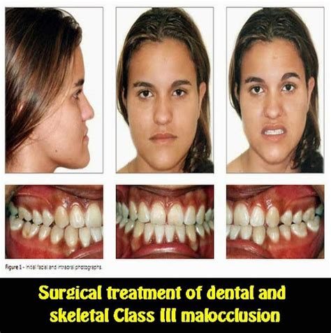 Ovi Dental