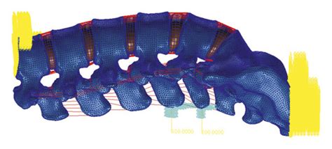 boundary constraint conditions of the whole lumbar spine download