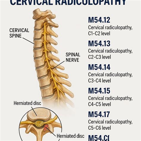 Icd 10 Codes For Cervical Radiculopathy Wmwtl