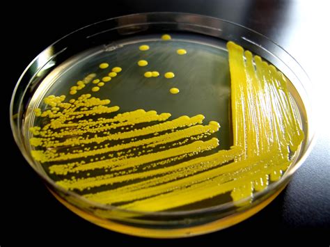Micrococcus Luteus On Agar Plate My Xxx Hot Girl
