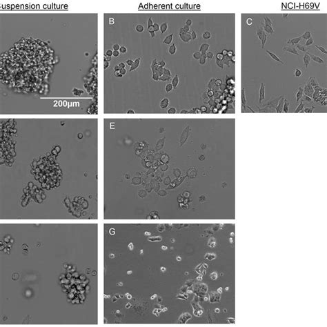 Morphologic Differences Within Sclc Cell Lines Nci H69 Sclc Cell Lines Download Scientific