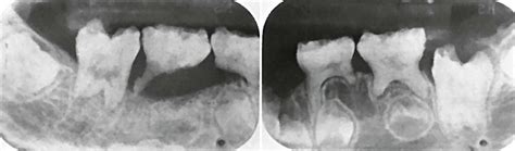 25 Systemic Diseases Pocket Dentistry