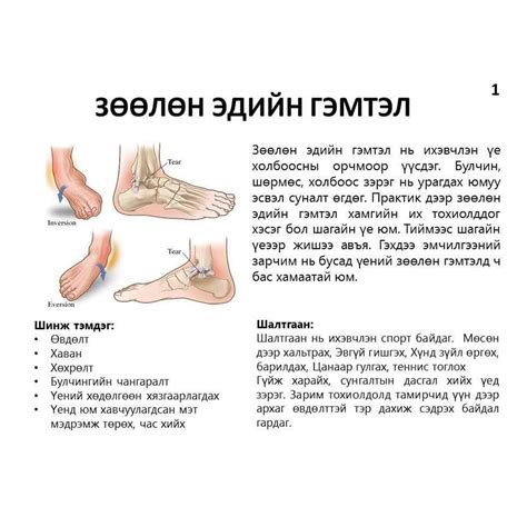 Эмчээс асууя ЗӨӨЛӨН ЭДИЙН ГЭМТЭЛ Зөөлөн эдийн гэмтэл нь Facebook