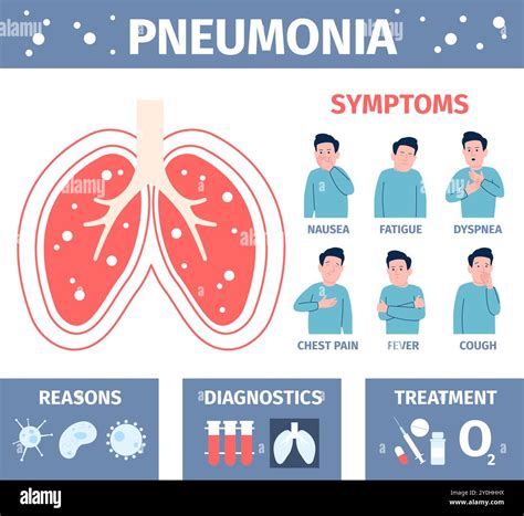 Pneumonia Symptoms Medical Poster With Man With Flu Symptom Cough