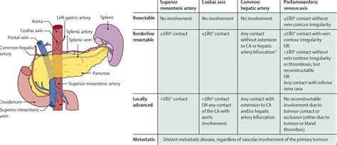 Pancreatic Cancer The Lancet
