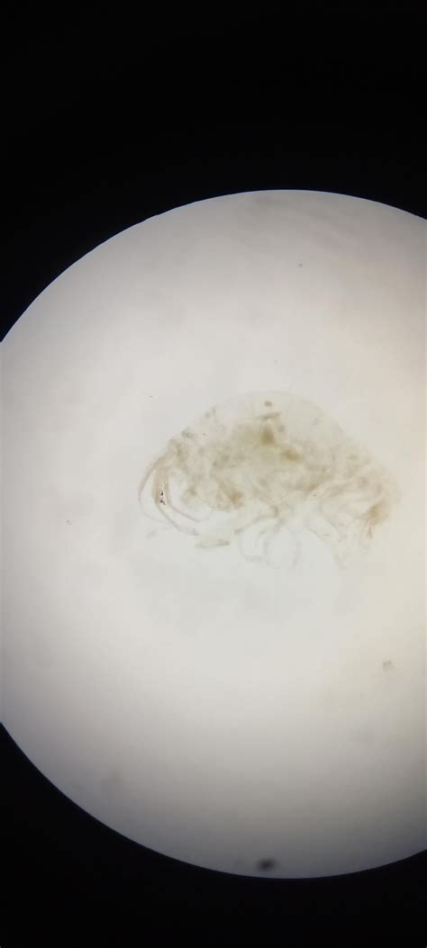 Difference Between 2 Microscopes Why Does The Second One Make The Specimen Look Bland And