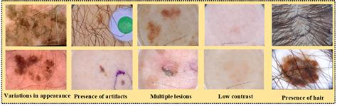 Emcad Efficient Multi Scale Convolutional Attention Decoding For