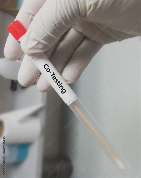 Vaginal Fluid Sample For Cervical Cancer Screening Co Testing Human