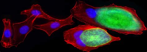 Inverted Fluorescence Microscope Molecular Microbiology Imaging
