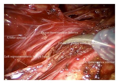 Fibers Of The Inferior Mesenteric And Superior Hypogastric Plexus Are