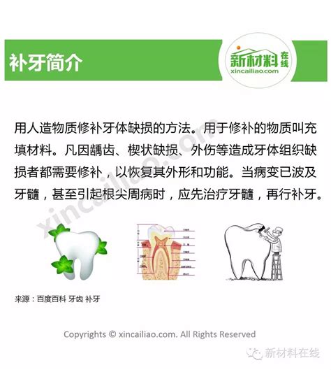 松风补牙材料 补牙材料 大山谷图库