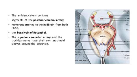 Anatomy Of Subarachnoid Cisterns Of Brain Ppt