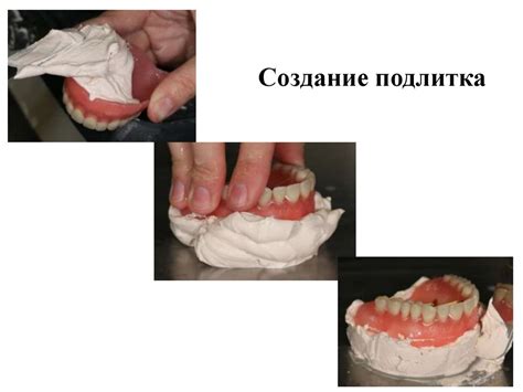 Починка пластиночного протеза презентация онлайн