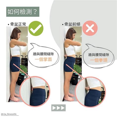 甩開凸小腹、假翹臀！教練公開「骨盆前傾矯正」5動作自我檢測，腰痠問題一併解決 Beauty美人圈