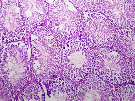 Testis Of Wistar Rat Treated With 4 Mgkg Body Weight Of Cannabis