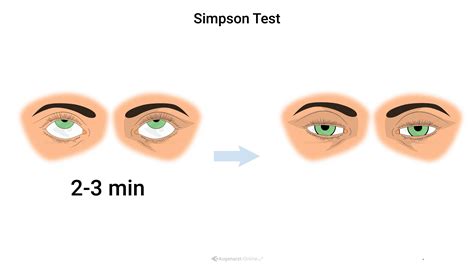 Simpson Test Atlas Der Augenheilkunde